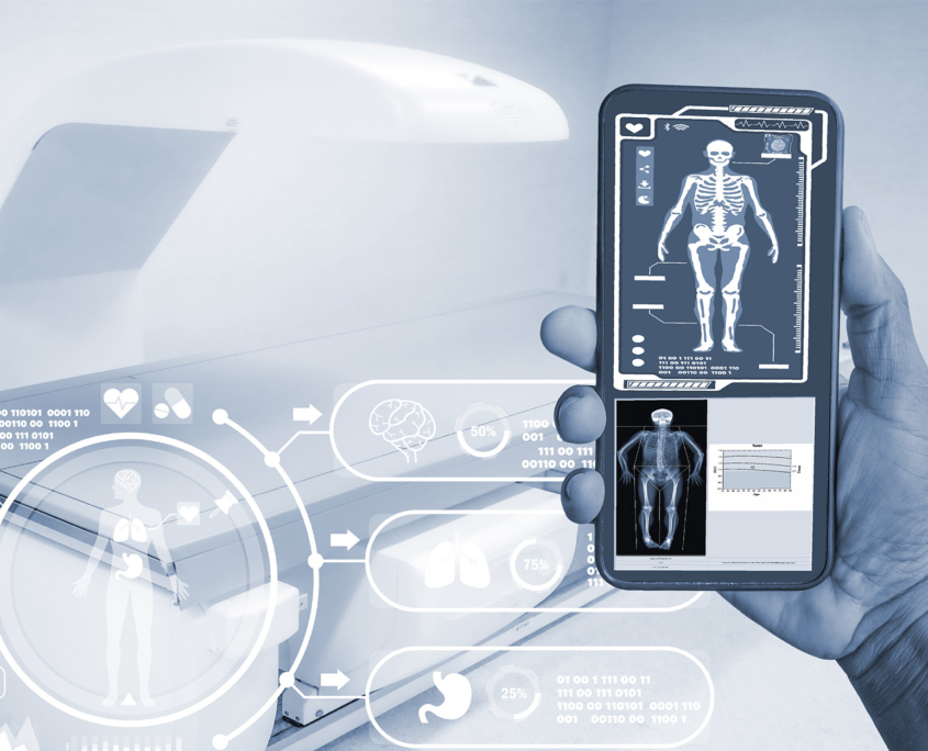 Understanding Bone Densitometry Machines: A Beginner’s Guide
