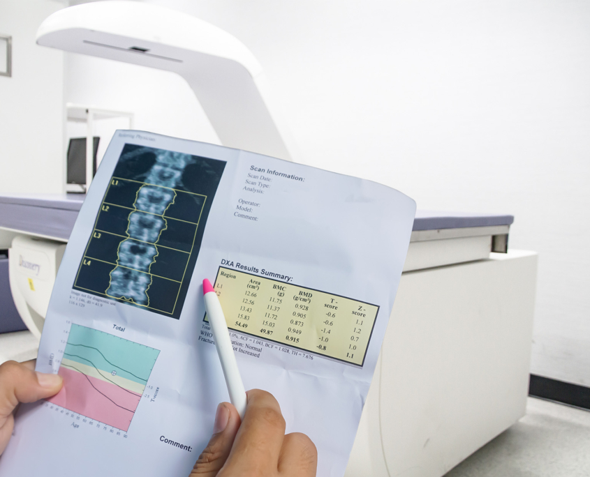 Types of Bone Density Scan Machines: A Comparison