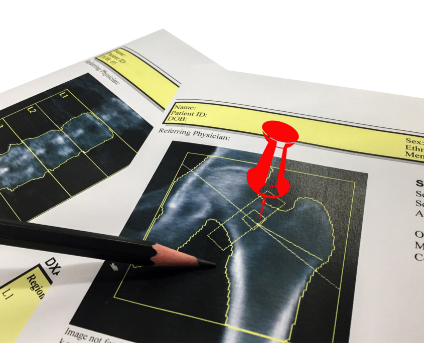 The Benefits of Hologic DEXA Body Composition Scans